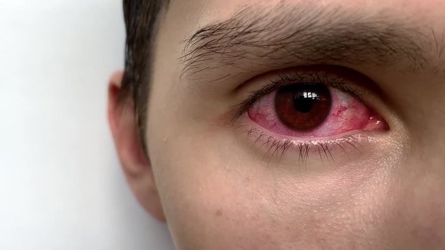 Red Eye Images – Browse 1,388,489 Stock Photos, Vectors, and Video ...