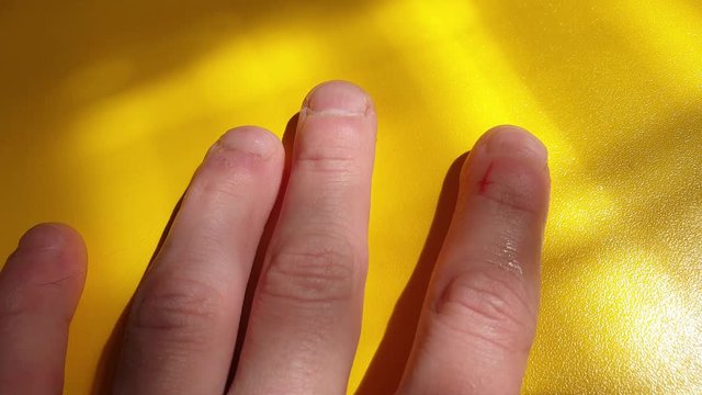 Finger Cut Images – Browse 683,249 Stock Photos, Vectors, and Video ...