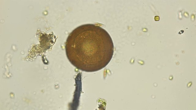 Difflugia Imagens – Procure 45 fotos, vetores e vídeos | Adobe Stock