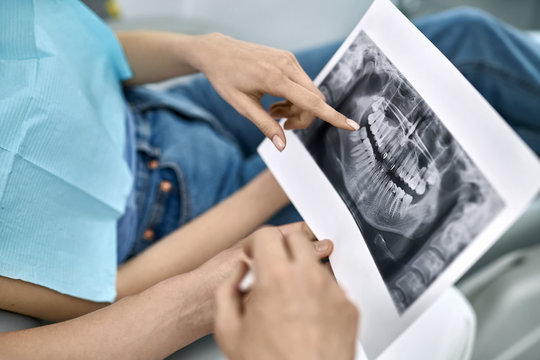 รูปภาพOpg – เลือกดูภาพถ่ายสต็อก เวกเตอร์ และวิดีโอ160 | Adobe Stock