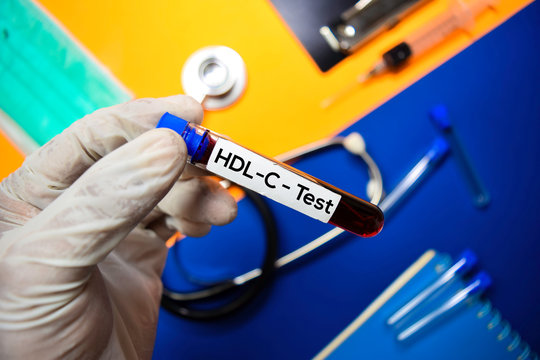 Hdl-C bilder – Bläddra bland 9 stockfoton, vektorer och videor | Adobe ...