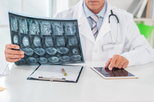 รูปภาพRentgen – เลือกดูภาพถ่ายสต็อก เวกเตอร์ และวิดีโอ400 | Adobe Stock