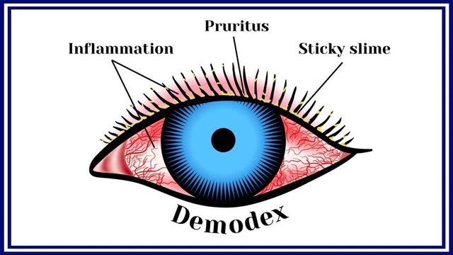 รูปภาพDemodex – เลือกดูภาพถ่ายสต็อก เวกเตอร์ และวิดีโอ307 | Adobe Stock