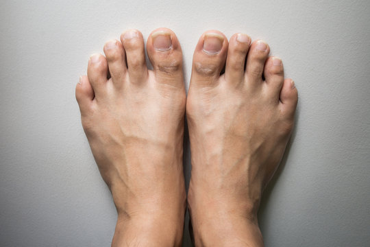 Mens Long Toenails