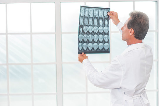 รูปภาพRentgen – เลือกดูภาพถ่ายสต็อก เวกเตอร์ และวิดีโอ400 | Adobe Stock