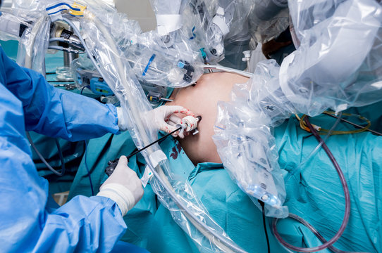 Coelioscopie Images – Parcourir 5,855 le catalogue de photos, vecteurs ...