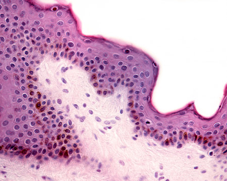 รูปภาพEpidermis – เลือกดูภาพถ่ายสต็อก เวกเตอร์ และวิดีโอ42,979 | Adobe ...