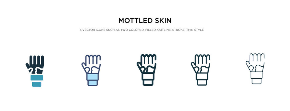 "Mottled Skin" Images – Browse 220 Stock Photos, Vectors, and Video ...