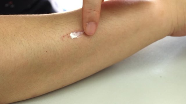 Keroid bilder – Bläddra bland 5 stockfoton, vektorer och videor | Adobe ...