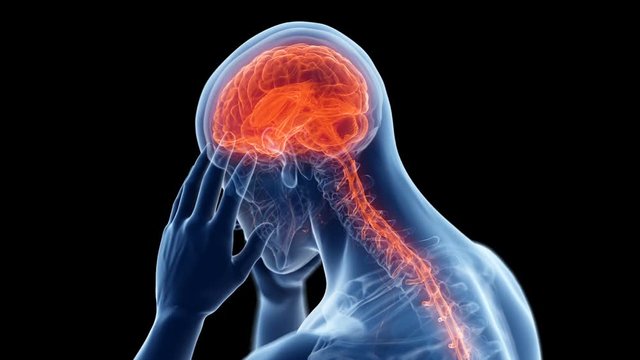 รูปภาพHeadache – เลือกดูภาพถ่ายสต็อก เวกเตอร์ และวิดีโอ664,160 | Adobe ...