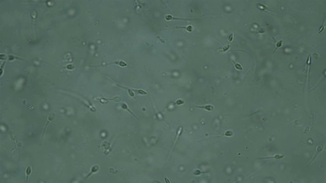 Flagellum Images – Parcourir 2,102 le catalogue de photos, vecteurs et ...