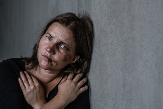 รูปภาพExtravasation – เลือกดูภาพถ่ายสต็อก เวกเตอร์ และวิดีโอ776 | Adobe ...