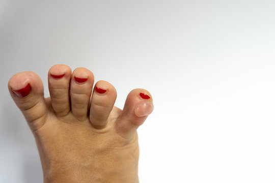 Helosis Images – Browse 14 Stock Photos, Vectors, and Video | Adobe Stock