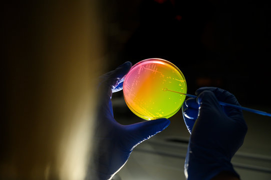 Microbal Bilder – Durchsuchen 81 Archivfotos, Vektorgrafiken und Videos ...