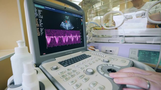 Sonographic Bilder – Durchsuchen 352 Archivfotos, Vektorgrafiken und ...