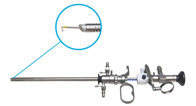 รูปภาพHysteroscope – เลือกดูภาพถ่ายสต็อก เวกเตอร์ และวิดีโอ421 | Adobe ...