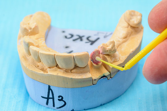 Orthodontal Bilder – Durchsuchen 1,462 Archivfotos, Vektorgrafiken und ...