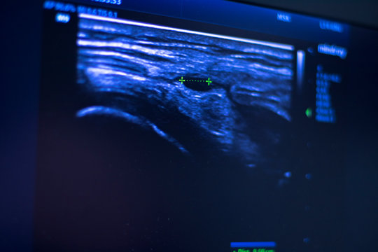 Ecography Images – Browse 15 Stock Photos, Vectors, and Video | Adobe Stock