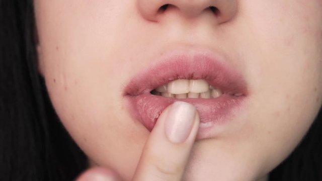 "Dry Lips" Images – Browse 1,326 Stock Photos, Vectors, and Video ...