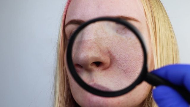 "Enlarge Pore" Images – Browse 105 Stock Photos, Vectors, and Video ...