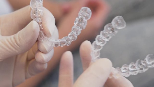 Invisalign Imagens – Procure 11,436 fotos, vetores e vídeos | Adobe Stock