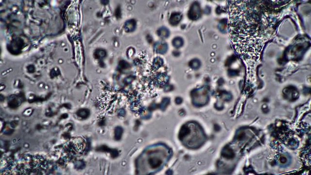 Bifidobacteria Video Footage – Browse 316 HD Stock Video and Footage ...