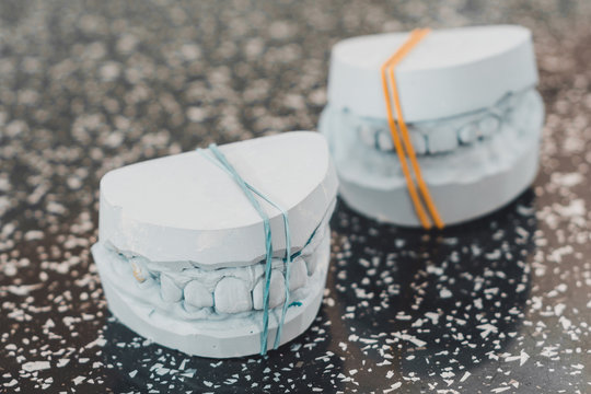 「Orthodontal」の画像 - 1,463 件の Stock 写真、ベクターおよびビデオ | Adobe Stock