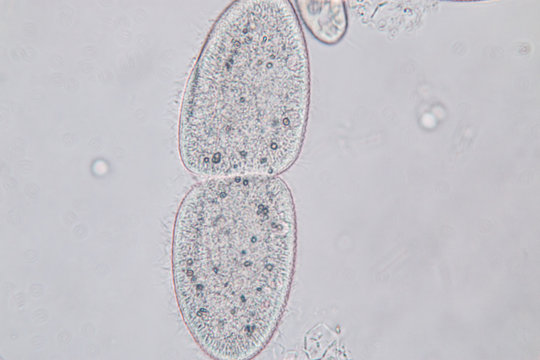 รูปภาพVacuole – เลือกดูภาพถ่ายสต็อก เวกเตอร์ และวิดีโอ7,369 | Adobe Stock
