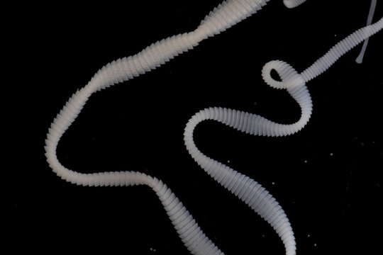 Tapeworm Rash