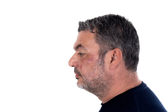 Beat Up Face Bilder – Durchsuchen 19,289 Archivfotos, Vektorgrafiken ...