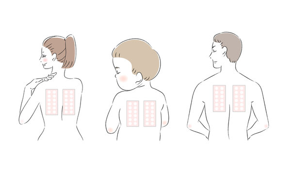 Epikutantest Bilder – Durchsuchen 227 Archivfotos, Vektorgrafiken und ...