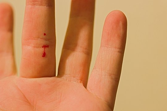 Finger Bleeding