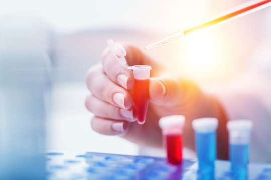 Blutanalyse Bilder – Durchsuchen 166,516 Archivfotos, Vektorgrafiken ...