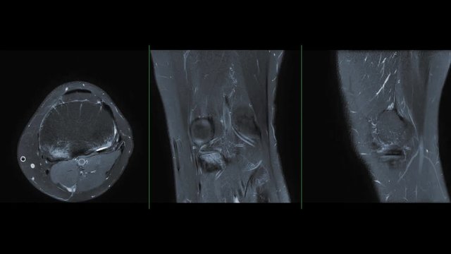 Coronal Imagens – Procure 5,970 fotos, vetores e vídeos | Adobe Stock