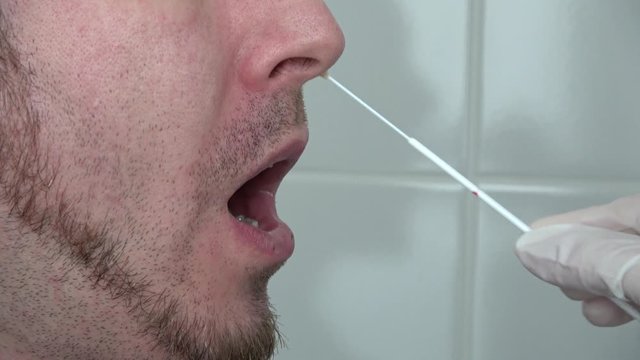 Abstrich Bilder – Durchsuchen 1,084 Archivfotos, Vektorgrafiken und ...