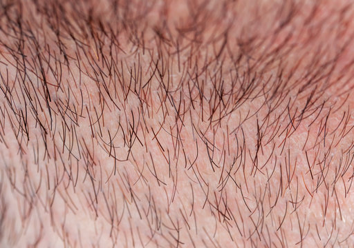 Stubble Texture