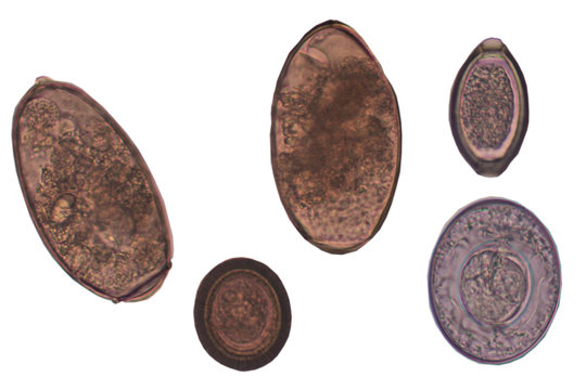Parasite Egg Images – HD & 4K Photos Free to Download | PikWizard