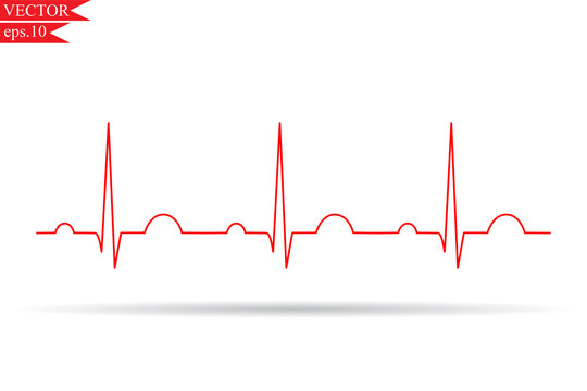 "Normal Sinus Rhythm" Images – Browse 2,886 Stock Photos, Vectors, and ...