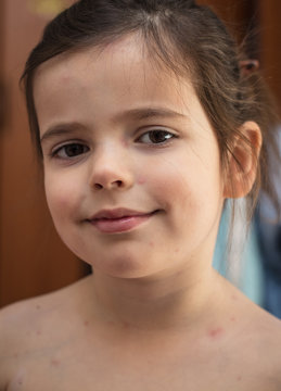 Imagens de Waterpox – Explore Fotografias do Stock, Vetores e Vídeos de ...