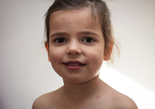 Waterpox Bilder – Durchsuchen 102 Archivfotos, Vektorgrafiken und ...