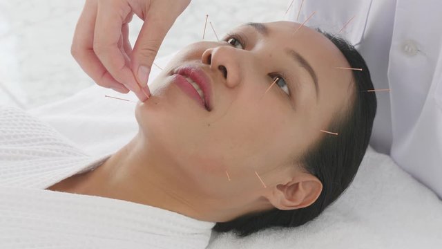 Acupuncture Face Asian Woman Images – Browse 1,273 Stock Photos ...