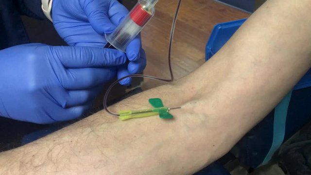Butterfly Venipuncture, 47% OFF | ids-deutschland.de