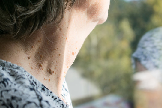 Shringles Images – Browse 1 Stock Photos, Vectors, and Video | Adobe Stock