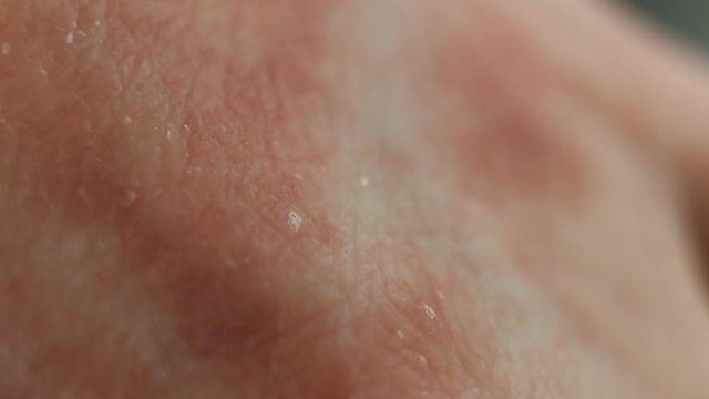 "Skin Writing" Images – Browse 152 Stock Photos, Vectors, and Video ...