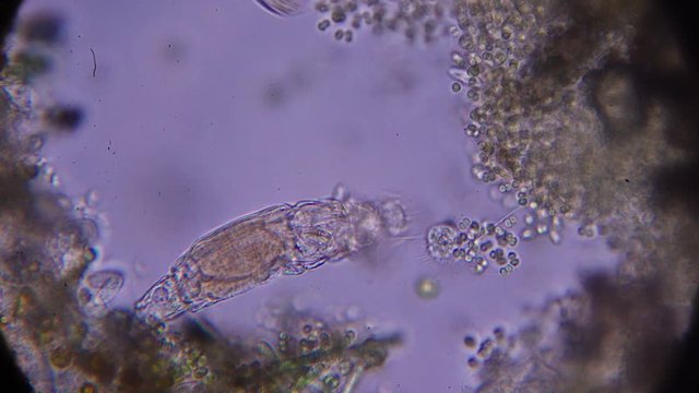 Ciliates Under Microscope