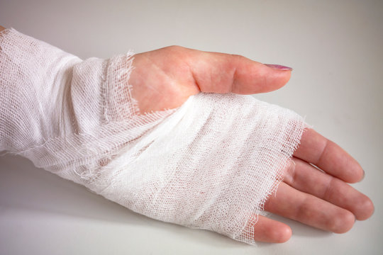 Burn Bandage Images – Browse 3,325 Stock Photos, Vectors, and Video ...