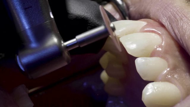 รูปภาพIncisal – เลือกดูภาพถ่ายสต็อก เวกเตอร์ และวิดีโอ68 | Adobe Stock