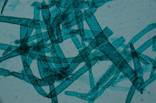 Moss Protonema Slide