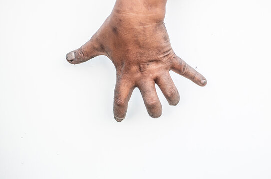 รูปภาพOdious – เลือกดูภาพถ่ายสต็อก เวกเตอร์ และวิดีโอ6,920 | Adobe Stock