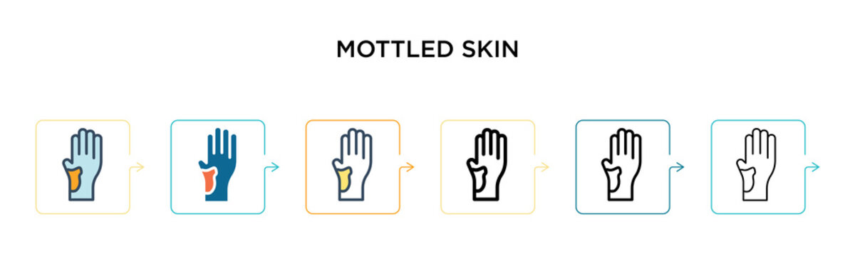 "Mottled Skin" Images – Browse 264 Stock Photos, Vectors, and Video ...